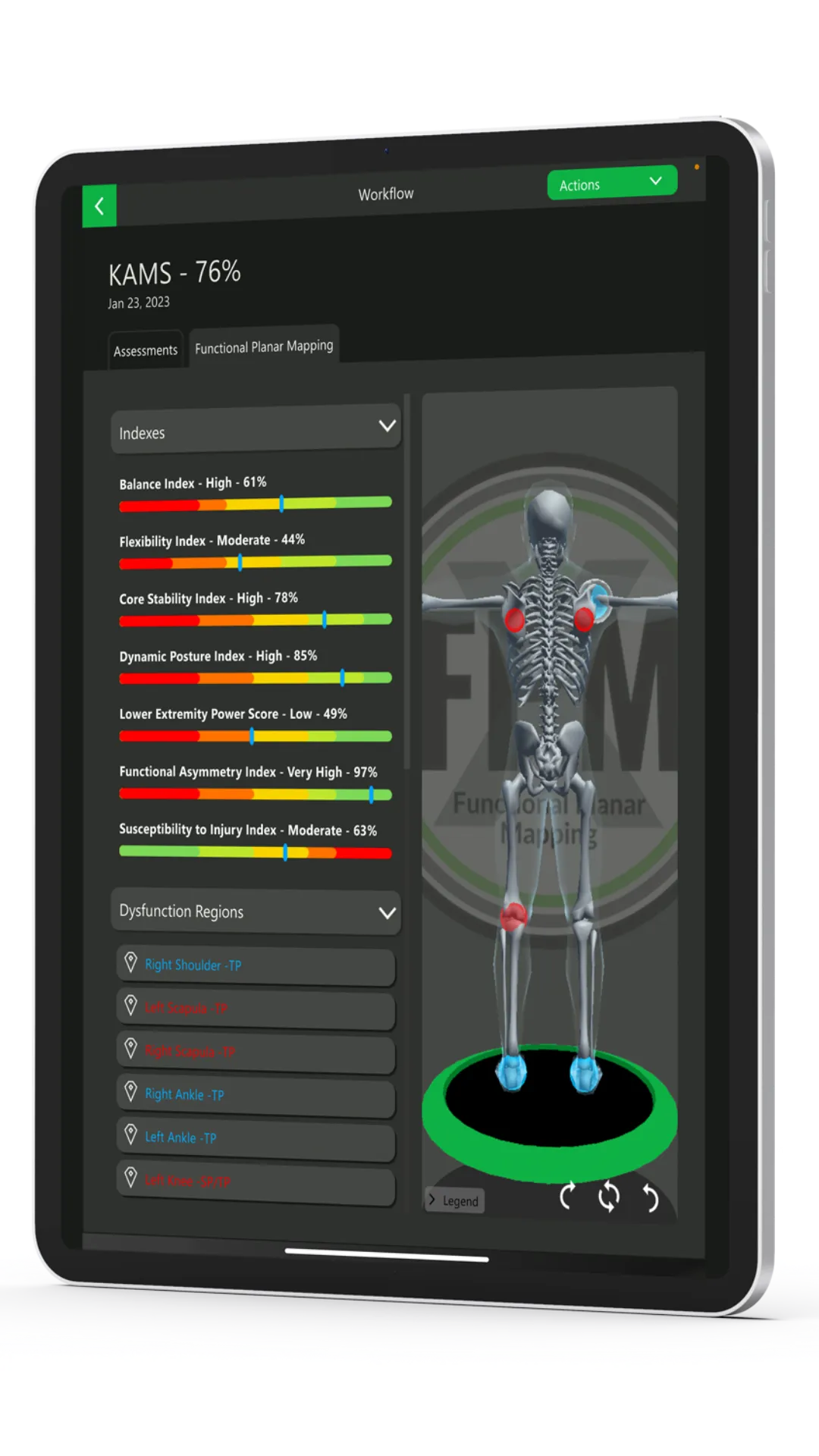 Kinetisense Clinical 3D Motion Capture Technology Applications